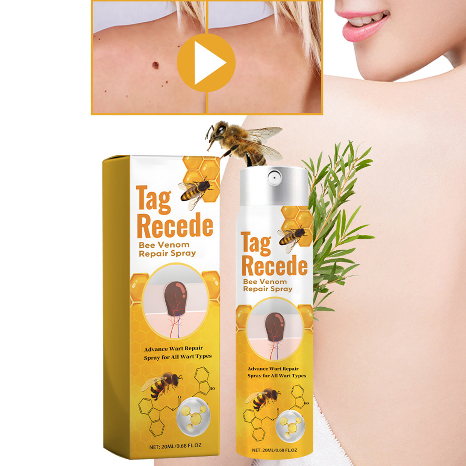 Leiity 20ml Spray Spray For Skin Tags Or Warts The Effectiveness Of Is ...